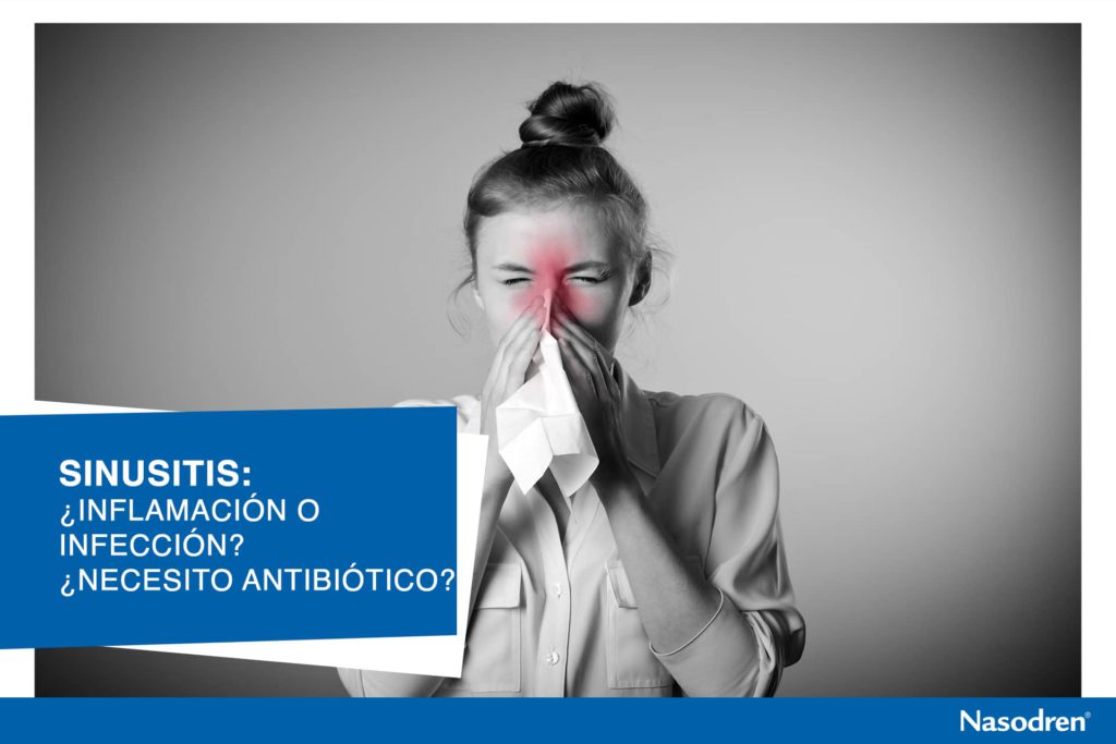 Sinusitis: ¿Inflamación o infección? ¿Necesito antibiótico? - Nasodren